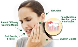 Teeth Pain on the Left or Right Side: Causes and Treatment