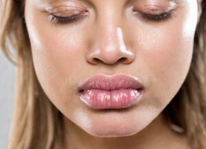 How to Get Rid of a Swollen Lip:14 Natural Remedies