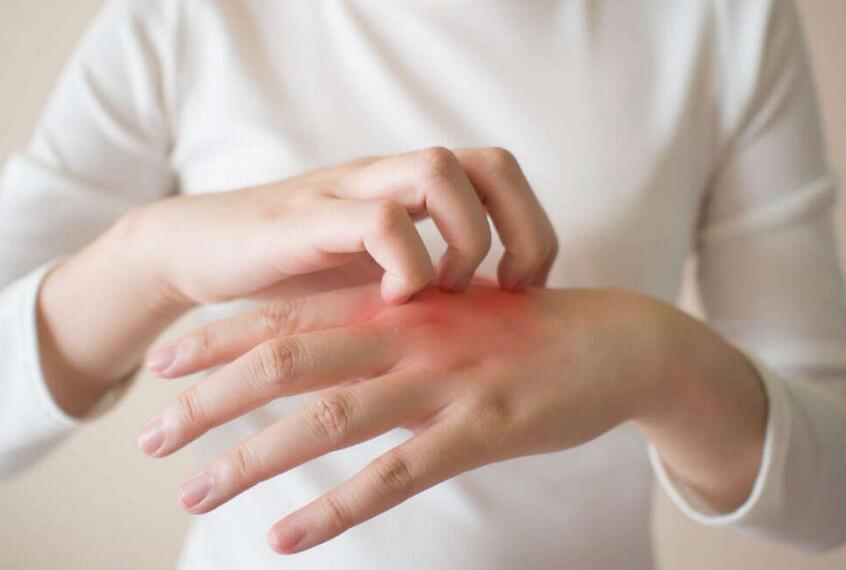 How to Stop Itching Skin Immediately:16 Easy Ways